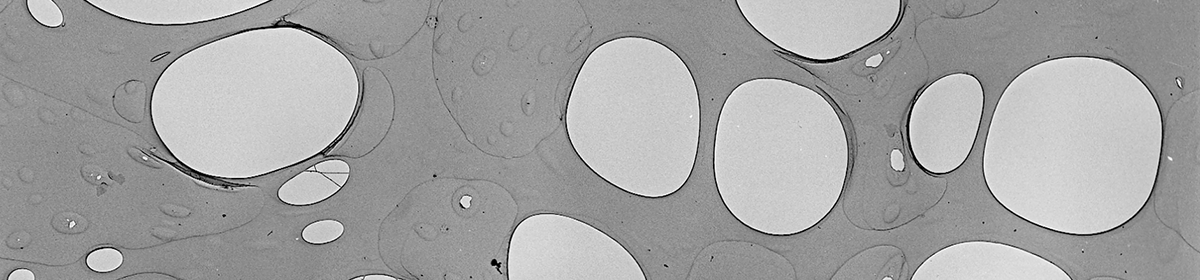 Holey Carbon Support films for TEM
